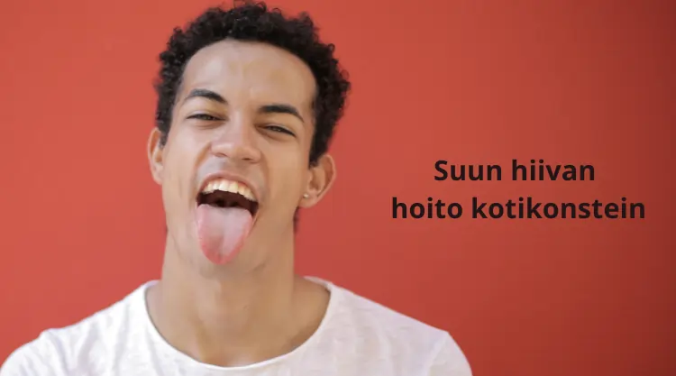 Suun hiivan hoito kotikonstein | Oireet ja hoito